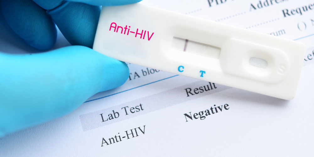 How Do At-Home STD Test Kits Work?
