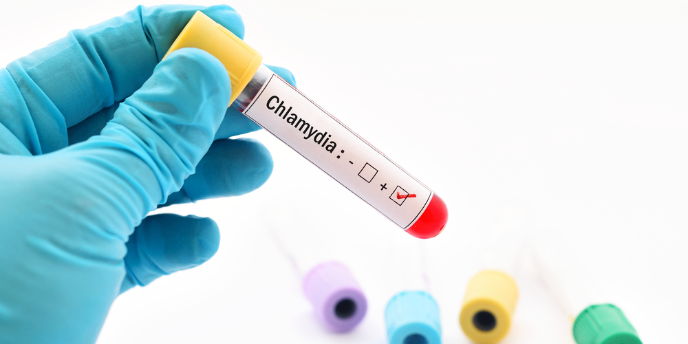 How to Treat Chlamydia Without Visiting a Doctor