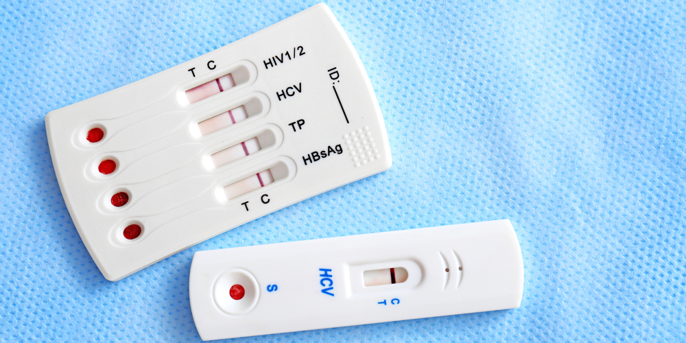 At Home Std Testing Kits Closer Look Into Reliability Of Growing