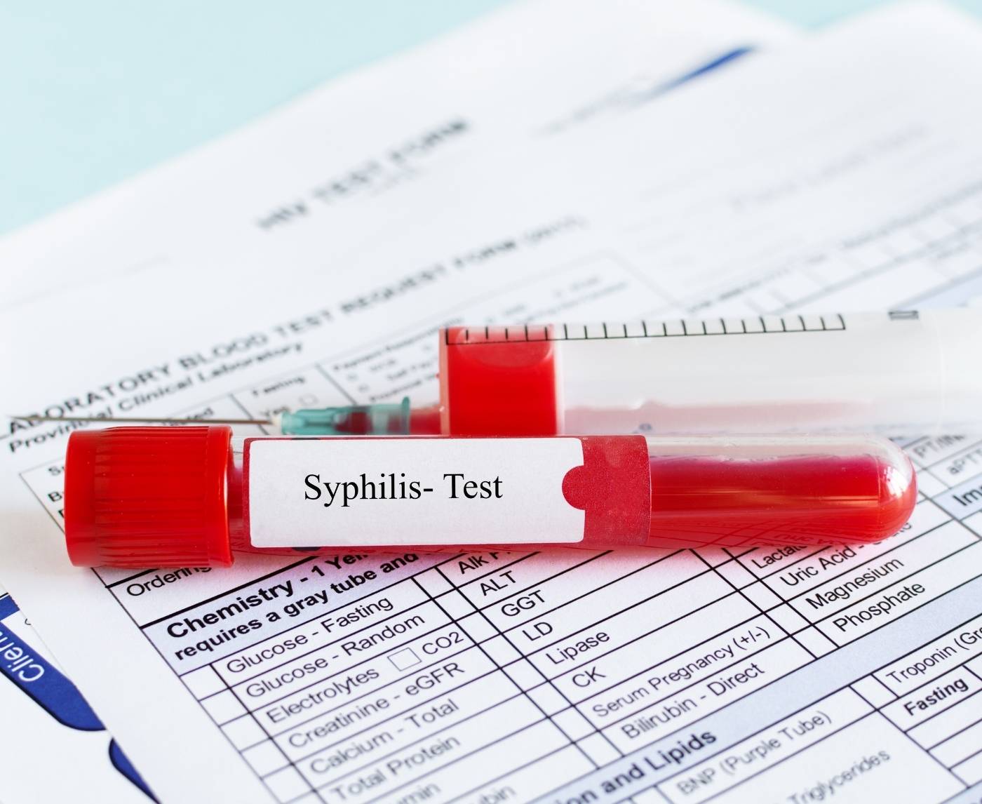 From Columbus to Penicillin: The Fascinating History of Syphilis