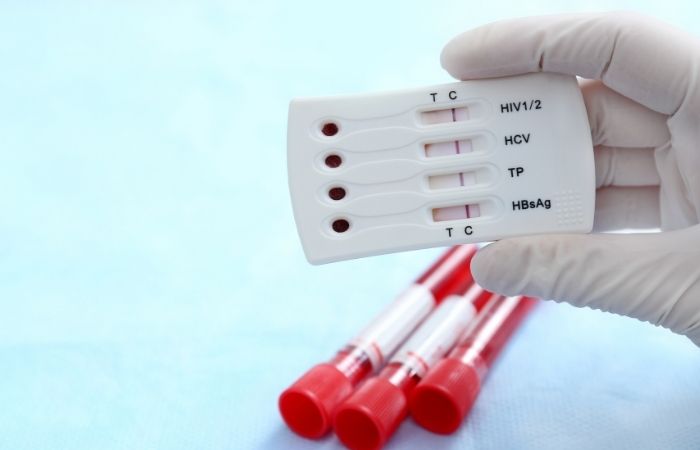 Why At Home Std Testing Is Key To Early Std Prevention
