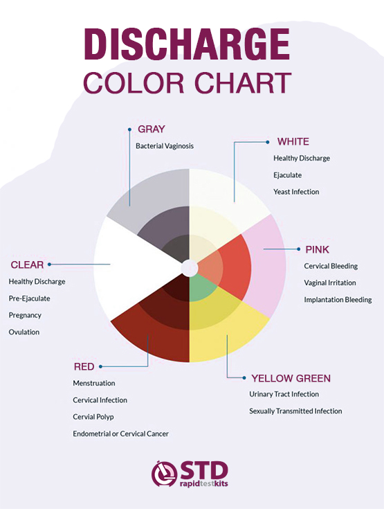 Vaginal Discharge and Symptoms of STDs